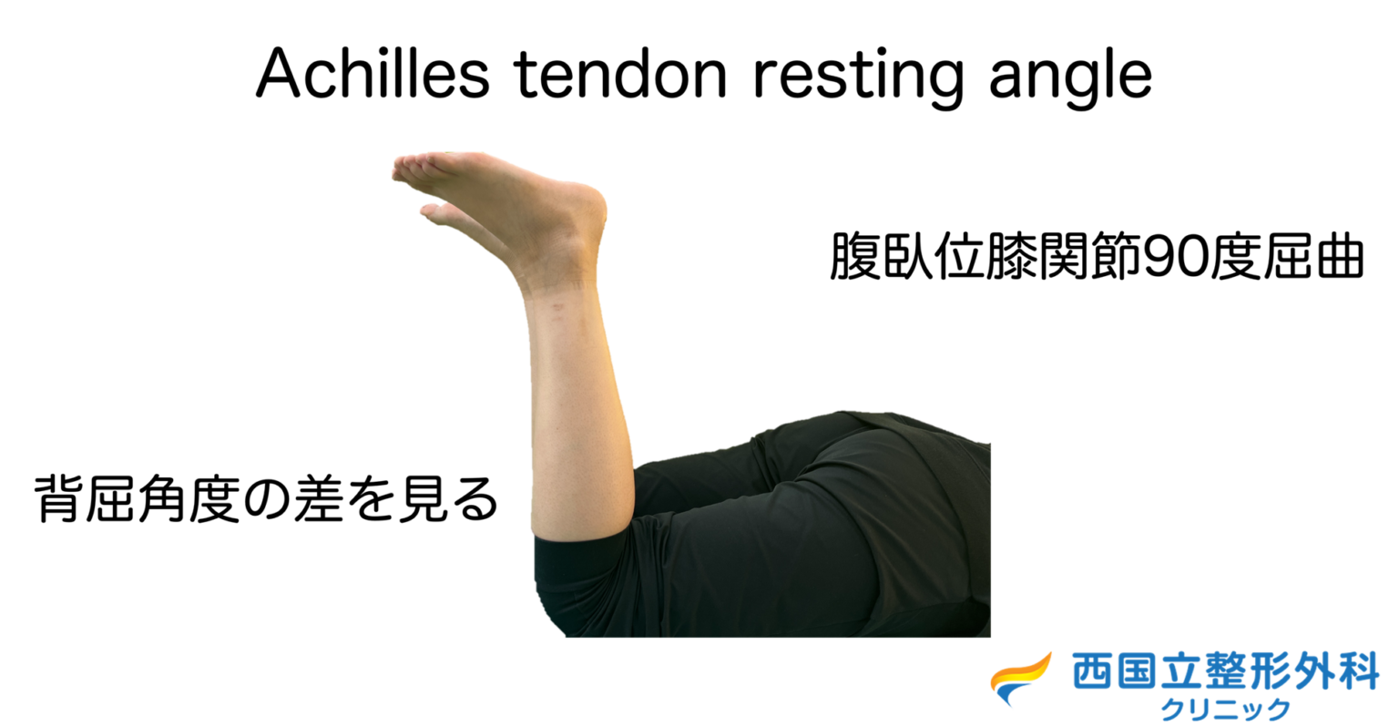 アキレス腱断裂について | 西国立整形外科クリニック